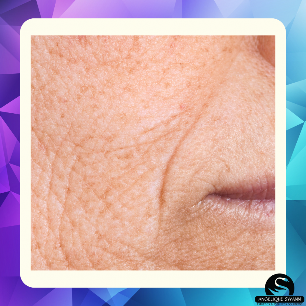 Wrinkles & Fine Lines: How to Smooth and Support Aging Skin - It's time ...