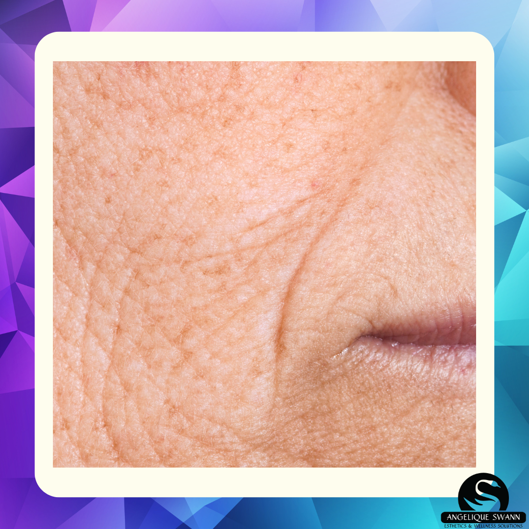 Wrinkles & Fine Lines: How to Smooth and Support Aging Skin - Vibrate ...